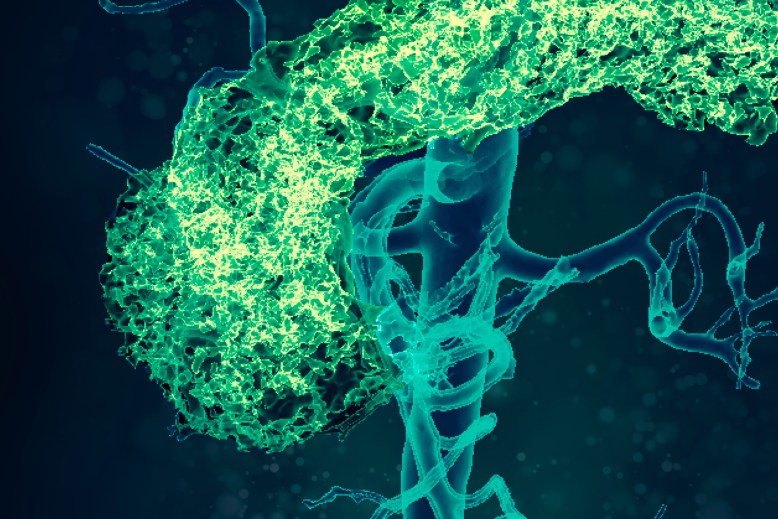 MSD Switzerland - Inventing for life | msd.ch